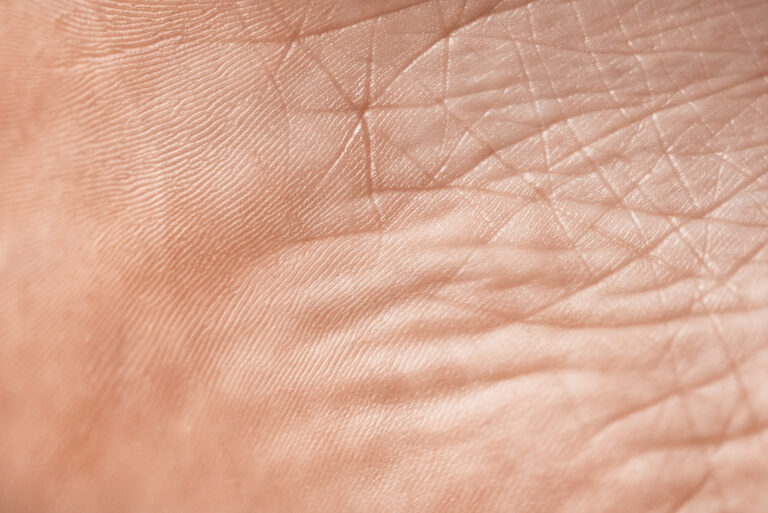 Dermatologie | Facharzt-Praxis | MEDIZINICUM Hamburg